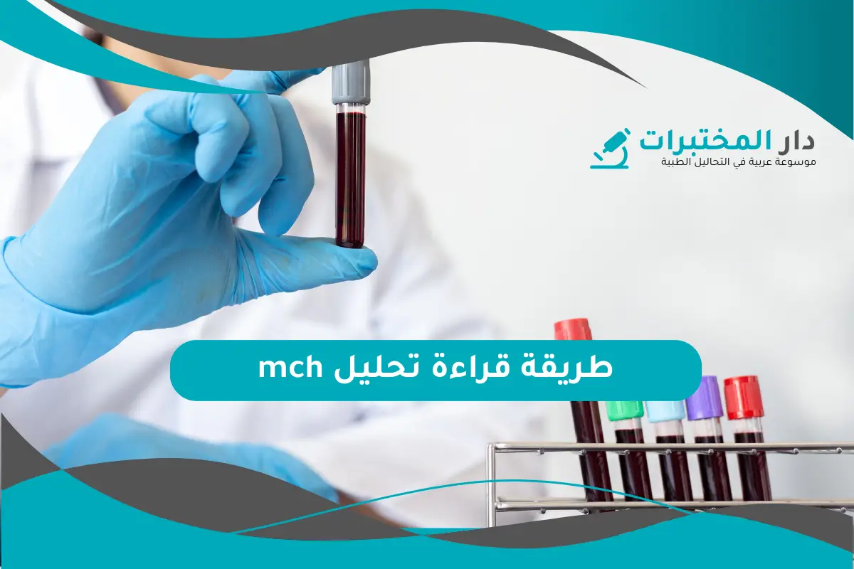 تحليل mch المعدل الطبيعي نسبة الارتفاع والانخفاض - دار المختبرات