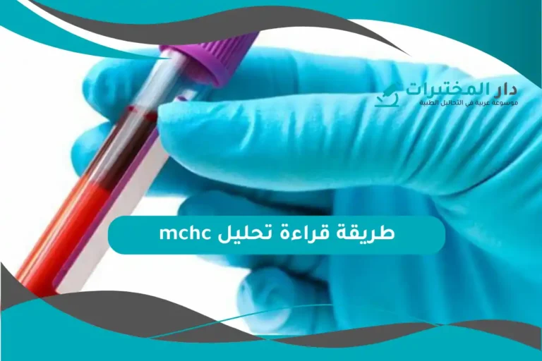 تحليل mch المعدل الطبيعي نسبة الارتفاع والانخفاض - دار المختبرات
