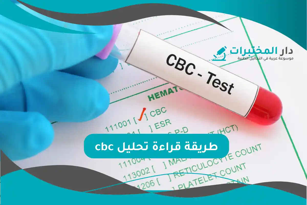 تحليل cbc المعدل الطبيعي نسبة الارتفاع والانخفاض - دار المختبرات